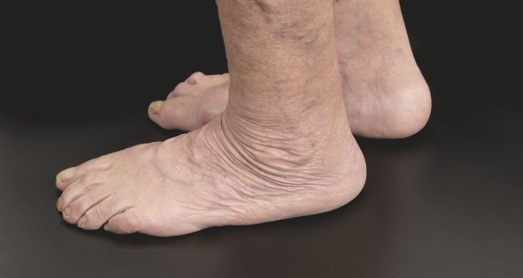 Aging Feet Changes And Problems FAQ | UgleeFeet