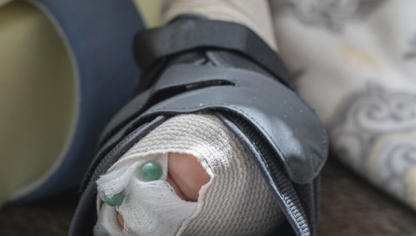 11 Different Types of Foot Surgeries - Uglee Feet